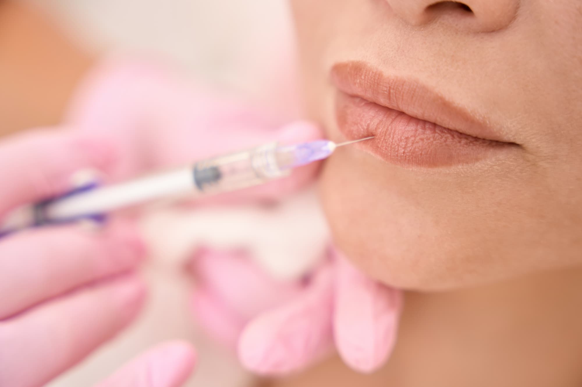 A Comprehensive Guide to the Types of Lip Fillers Available